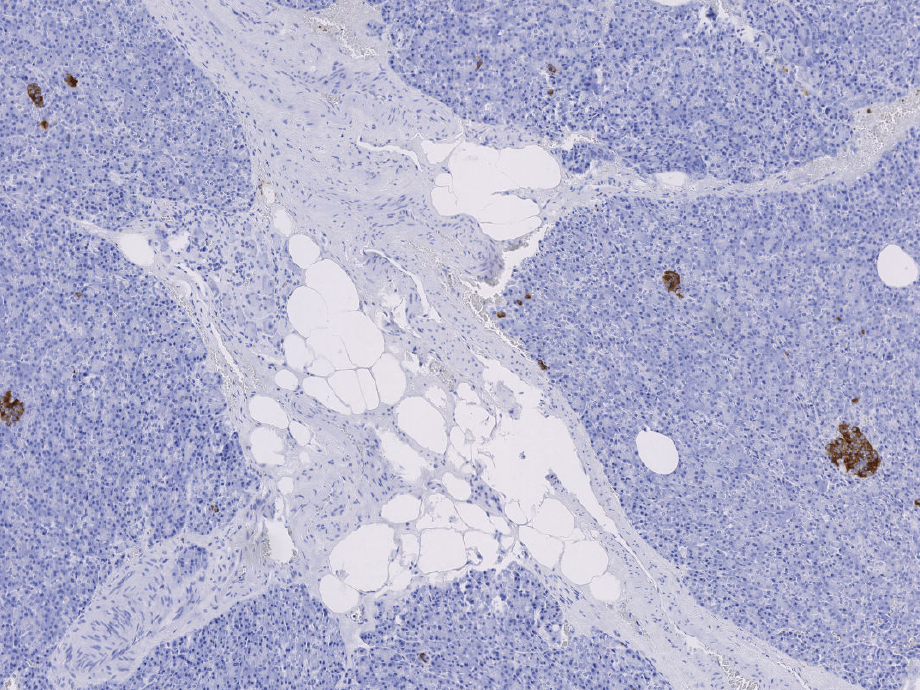 Understanding and analyzing biopores and plant roots in Soil Cores using Semantic Segmentation ...