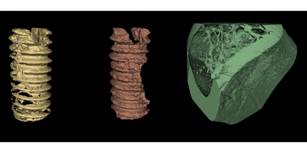 Segmentation of biodegradable bone implants – helmholtz-imaging.de