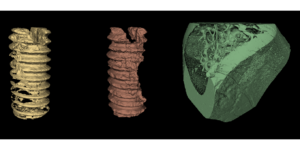 Segmentation of biodegradable bone implants – helmholtz-imaging.de