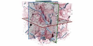 Understanding and analyzing biopores and plant roots in Soil Cores using Semantic Segmentation ...