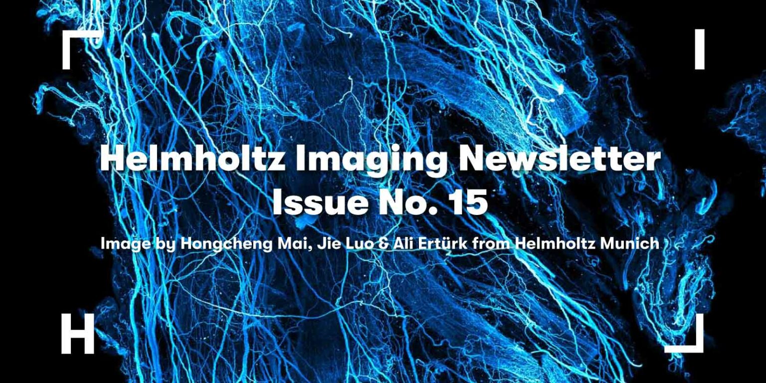 Helmholtz Imaging Newsletter Issue No. 15 – helmholtz-imaging.de