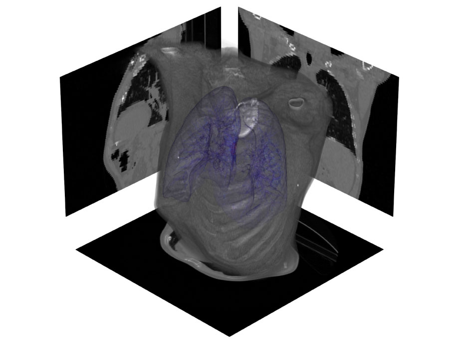 helmholtz-imaging.de