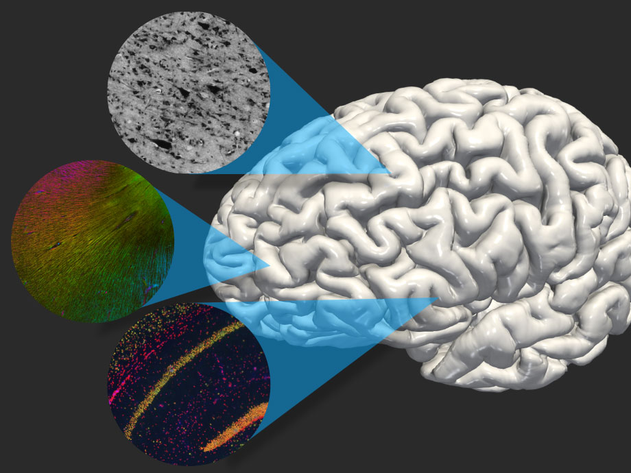 helmholtz-imaging.de