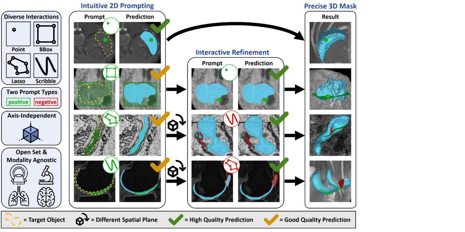 nnInteractive: A Breakthrough in AI-Driven 3D Interactive Segmentation ...