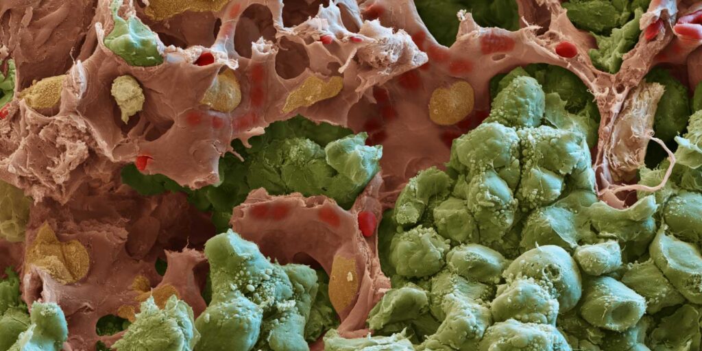 SCHEMA – profiling Spatial Cancer HEterogeneity across modalities to ...