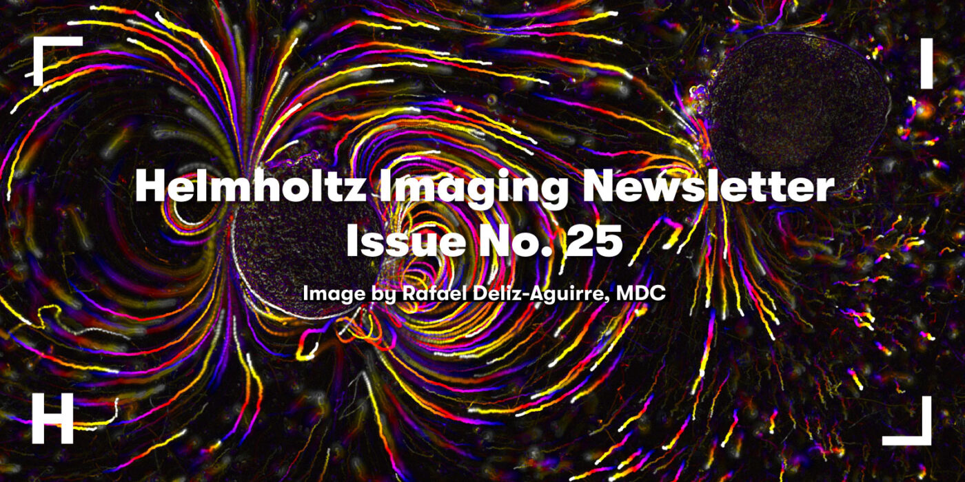 Helmholtz Imaging Newsletter Issue No. 25 – helmholtz-imaging.de